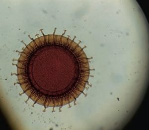 Phylum Ectoprocta (Bryozoa) - EazyBio: Educate, Elevate, Empower